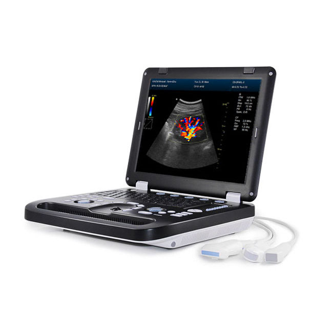 Portable Doppler veterinary ultrasound system - DCU50 - Xuzhou Kaixin ...