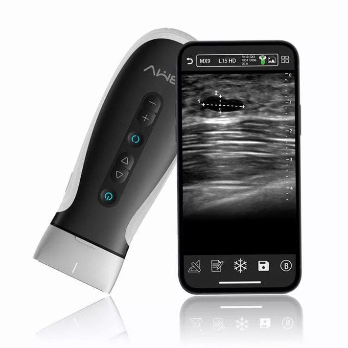 Portable ultrasound scanner - MX9 - bmv-vet - for large animals / for ...