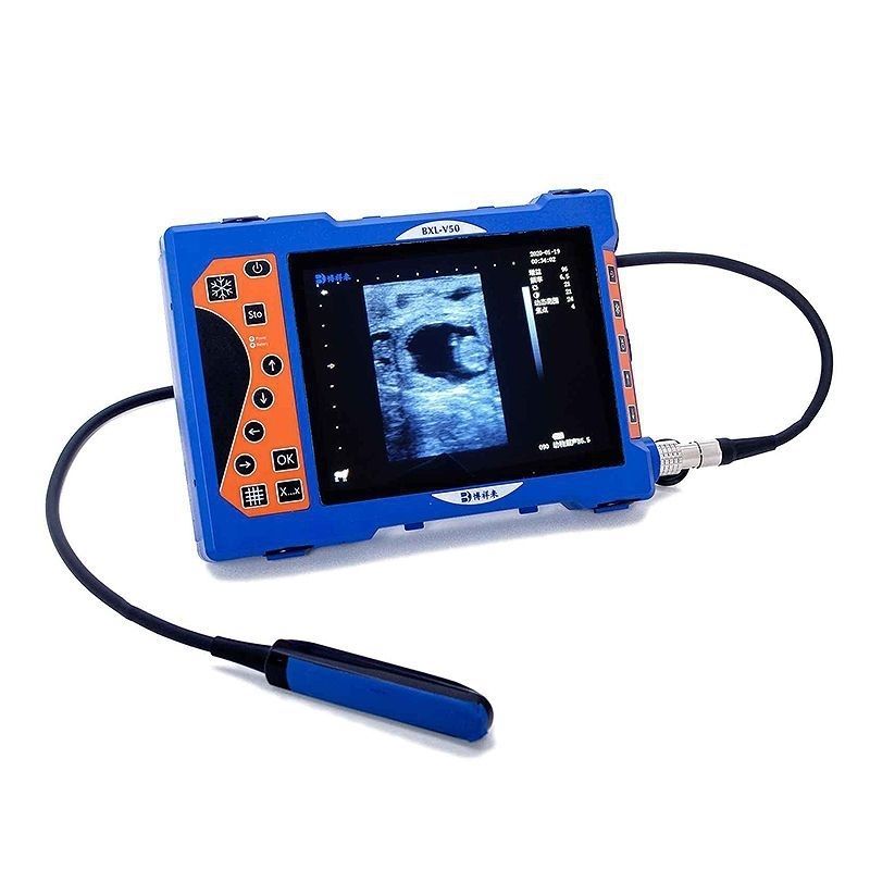 Portable ultrasound scanner - BXL-V50 - Zhengzhou Boxianglai Electronic ...